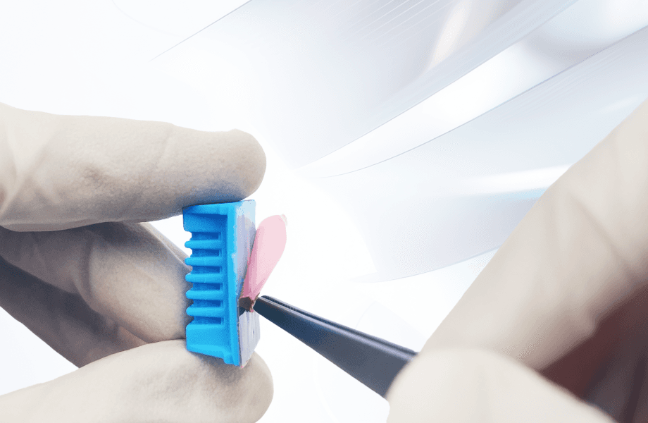 Ligation Solutions – Surgical Clip Systems