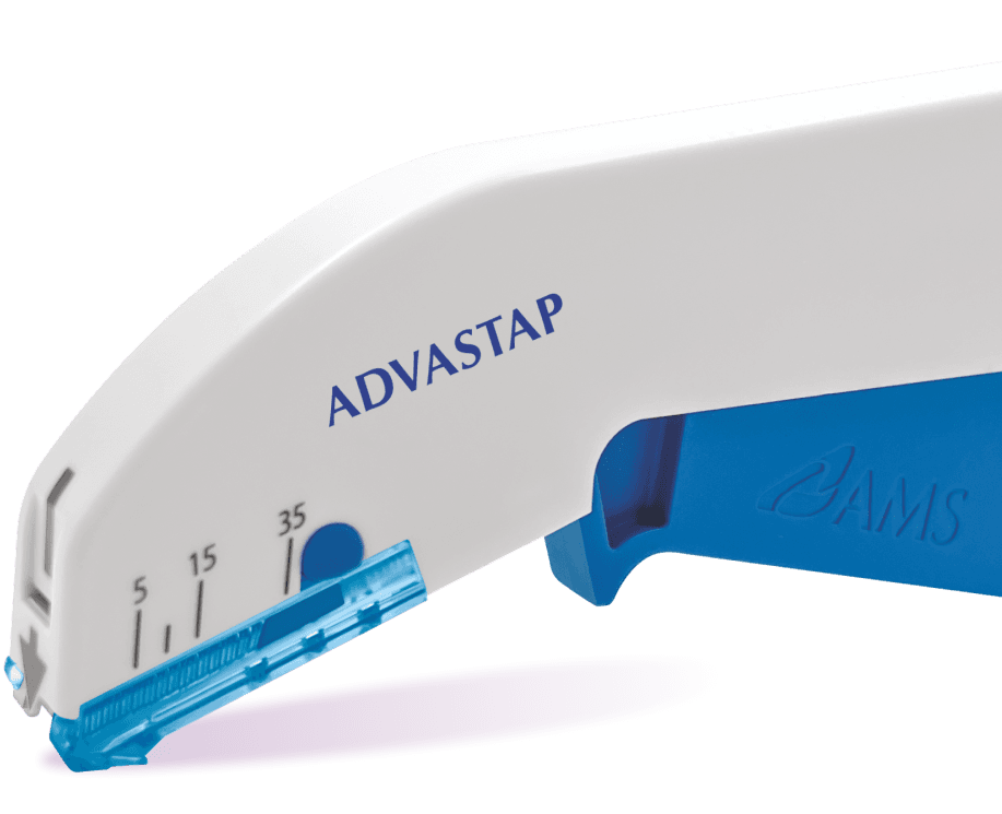 Advastap Skin Stapler | AMS Wound